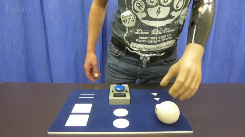 Main bionique - Sciences et Avenir